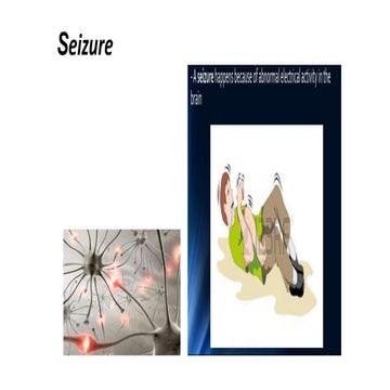Introduction To Seizure And Epilepsy Ppt Ppt