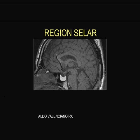 Anatomia de region selar | PPT