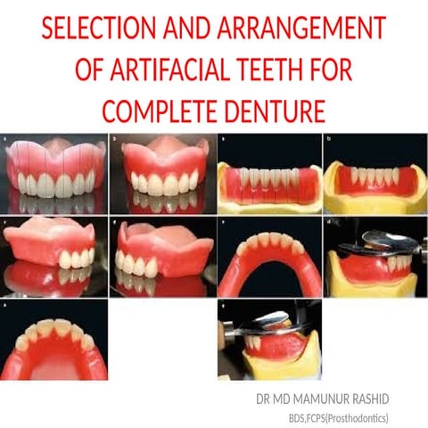 SELECTION AND ARRANGEMENT OF ARTIFACIAL TEETH FOR COMPLETE.pptx