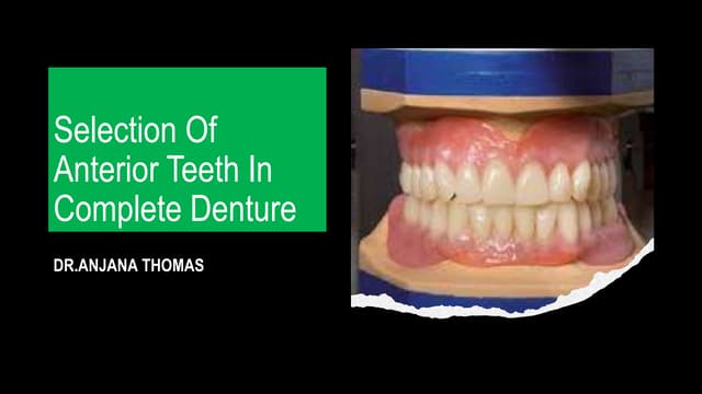 Anterior tooth selection | PPTX