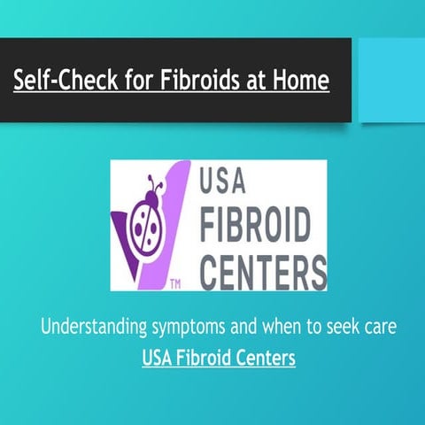 Local UFE Fibroid Treatment Options at USA Fibroid Centers.pptx