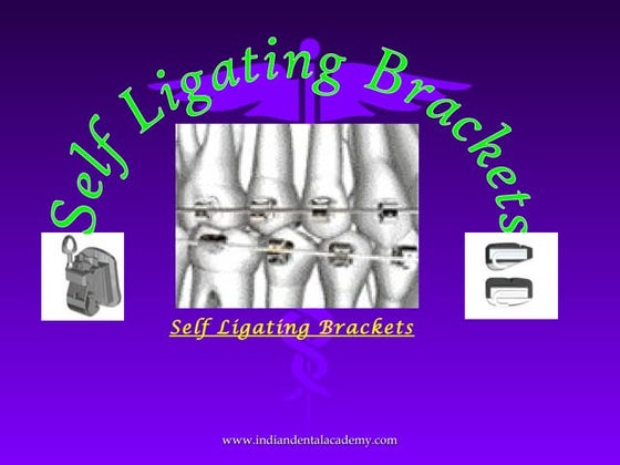 mbt bracket placement | PPT