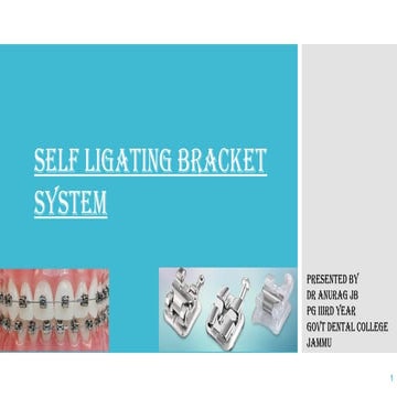 Self ligating Bracket System.pptx................ | PPTX