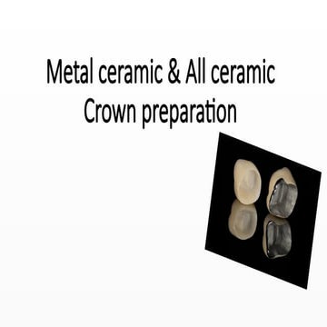 Porcelain jacket crown (PJC) | PPTX