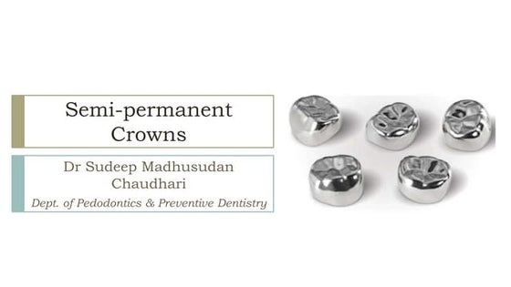 The metal ceramic crown preparation | PDF