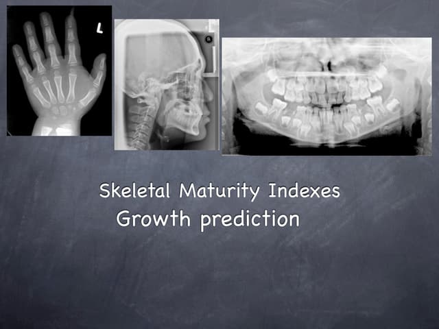 Skeletal maturity index | PPTX