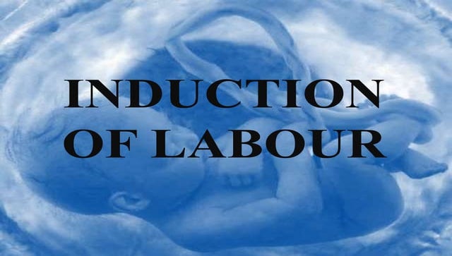Induction of Labour | PPT