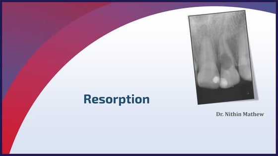 External root resorption (ERR) | PPTX | Dental Health | Diseases and ...