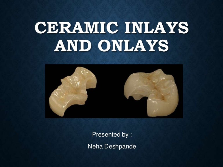 Ceramic inlays and onlays
