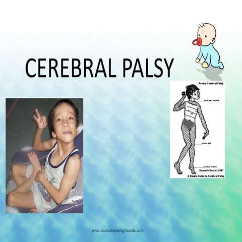 Cerebral palsy | PPTX