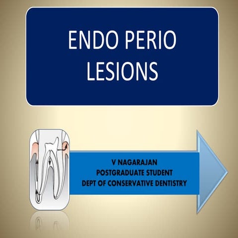 Endo - Perio lesions | PPTX