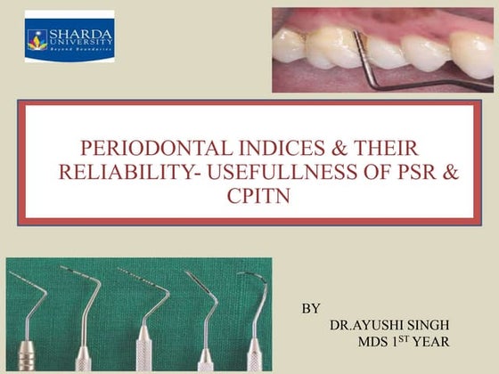 Oral Hygiene Index (OHI) and Oral Hygiene Index-Simplified (OHI-S) | PPTX | Dental Health ...