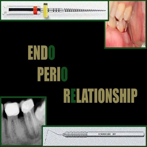 Endodontic Periodontal Relationship, ENDO PERIO LESION | PPTX
