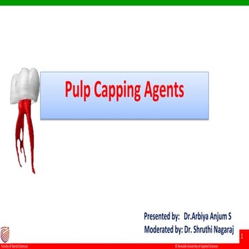 Pulp Capping Agents | PPTX