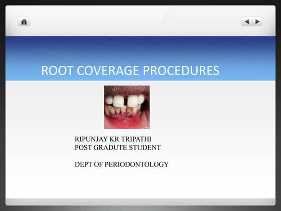 Periodontal Sutures | PPTX
