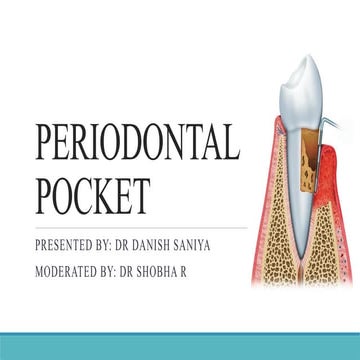 Seminar 8 Periodontal pocket part-1.pptx