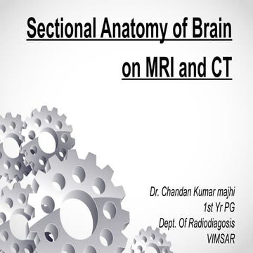 seminar brain anatomy on brain ct .pptx