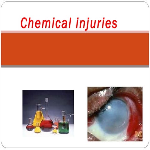 Seminar chemical injuries | PPT