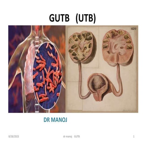 Surgical management of Genitourinary TB.pptx