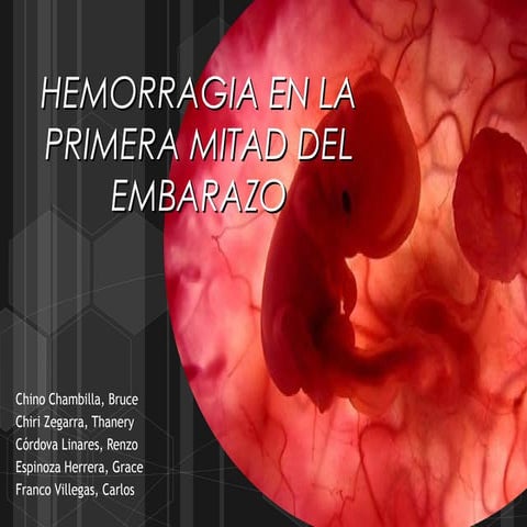 Seminario 04 hemorragia en la primera mitad del embarazo | PPT