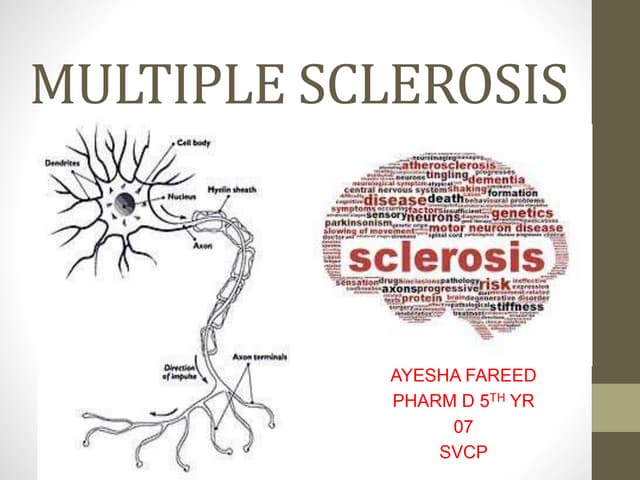 Multiple sclerosis CASE PRESENTATION | PPTX