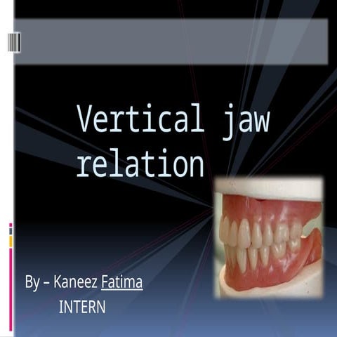Vertical jaw relation in Complete Dentures- Kelly | PPTX