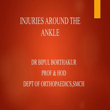 Pott’s fracture | PPTX