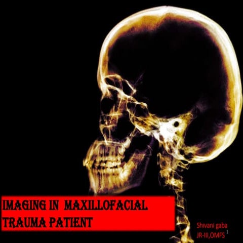 conventional radiography in maxillofacial trauma | PPTX