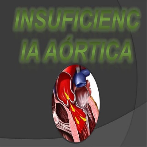 Semiología de insuficiencia aórtica | PPTX
