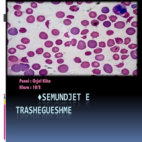 Semundjet e trashegueshme | PPTX