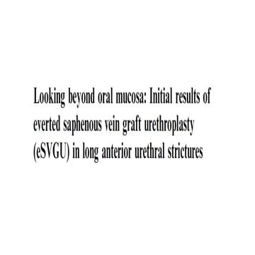 Sephaneous vein graft for anterior urethral stricutre | PPTX