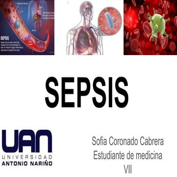 sepsis.pptx