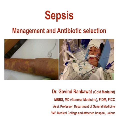 Sepsis managment in hospitalized patients | PPTX