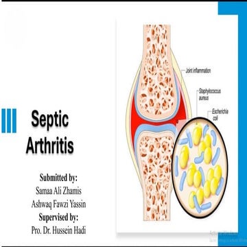 Septic Arthritis 1 Normall.pptx