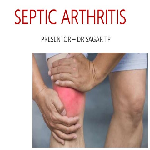 Septic arthritis | PPTX | Infectious Diseases | Diseases and Conditions