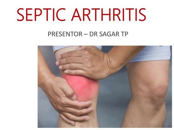 septic arthritis-1.pptx