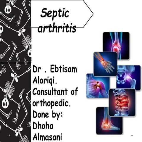 septic arthritis.pptx