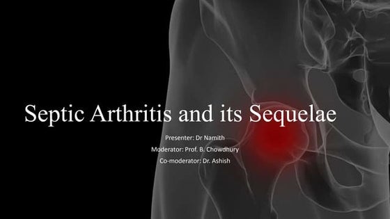 Approach to child with leg pain-Septic arthritis | PPT