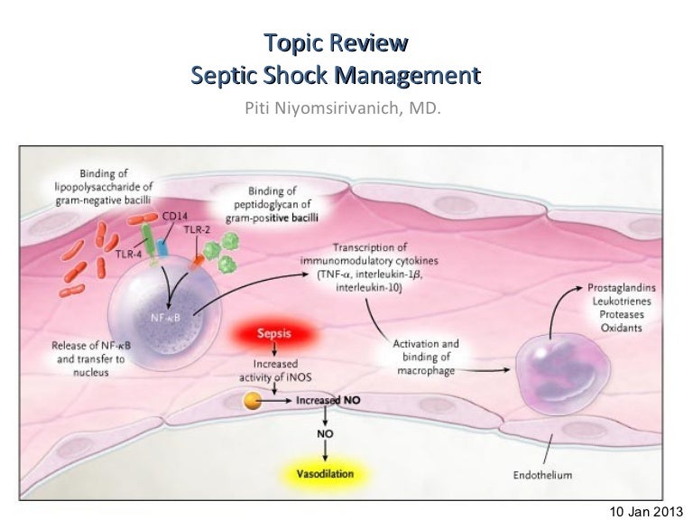 Septic shock