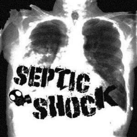 Septic shock presentation | PPTX