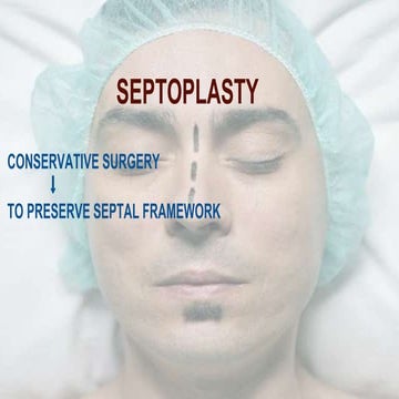 septoplasty procedure _.pptx