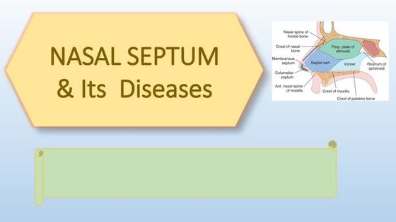 Dns (Deviated Nasal Septum) | SurgicoMed.com