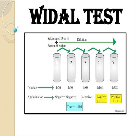 Serological test as widal for diagnosis of disease.pptx