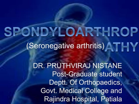 Immobility (Bed Rest Complications) | PPTX | Bone and Joint Conditions ...