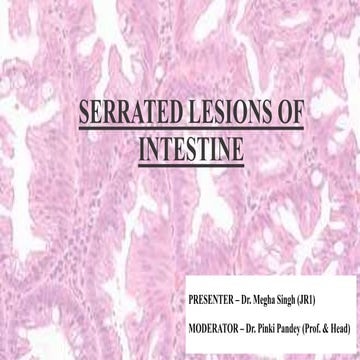 SERRATED LESIONS OF INTESTINE GI tract.pptx