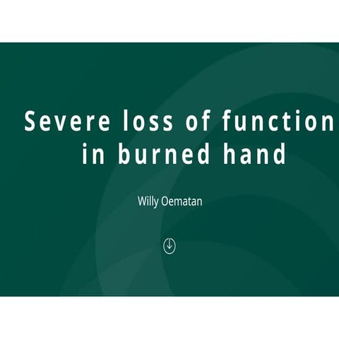 Severe_Loss_Function_Burned_Hand_Presentation.pptx