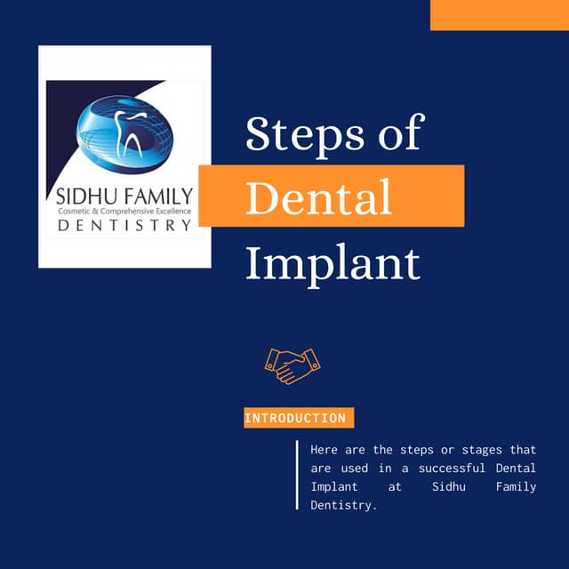 Sfdfresno-steps of Dental Implant | PDF
