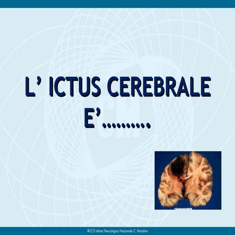 Immagini dell'Ictus | PPT