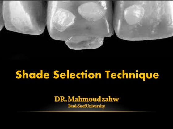 Shade Selection techniques 1 | PPT | Dental Health | Diseases and ...