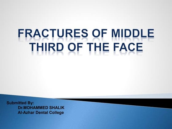 ZMC FRACTURE / zygomatico maxillary complex fracture. fracture | PPT